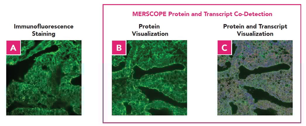 Vizgen MERSCOPE Protein Co-Detection Vizgen MERSCOPE Protein Co-Detection